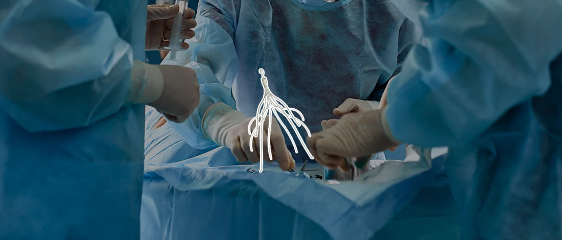 Cook Medical IVC Filter Lawsuit 2025 Update: Latest News