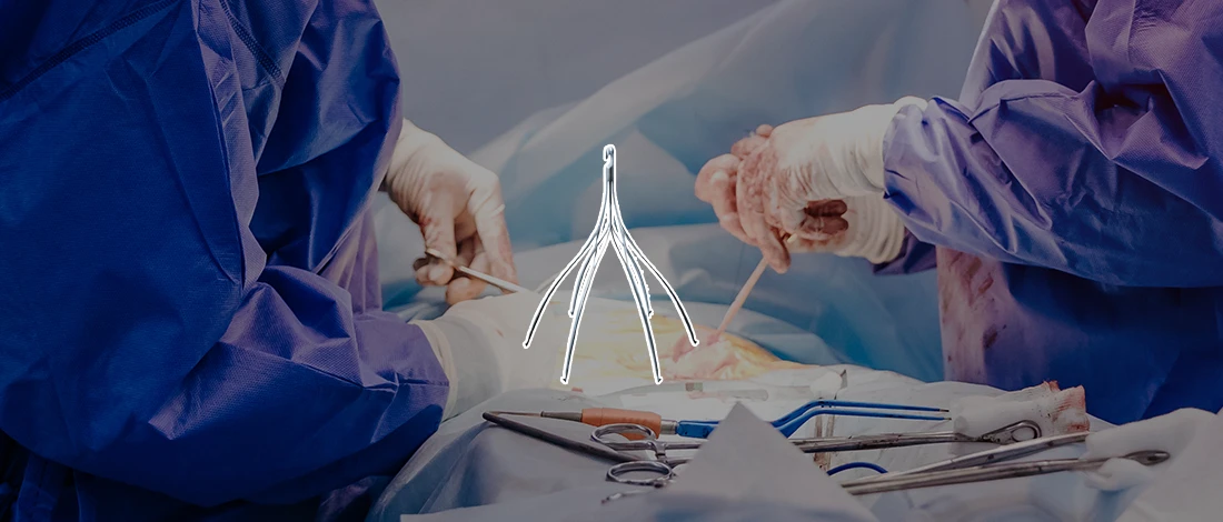 Option ELITE IVC Filter Lawsuit (2025 Update)