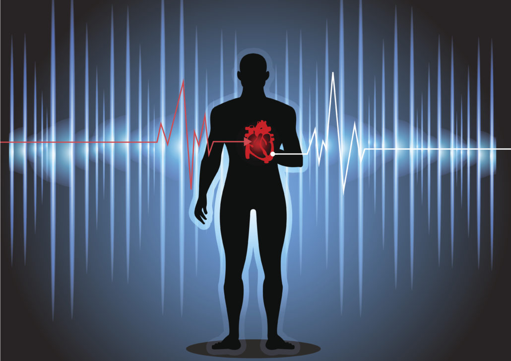 Argon IVC Filter Class Action Lawsuit | OptionELITE IVC Filter Lawyer